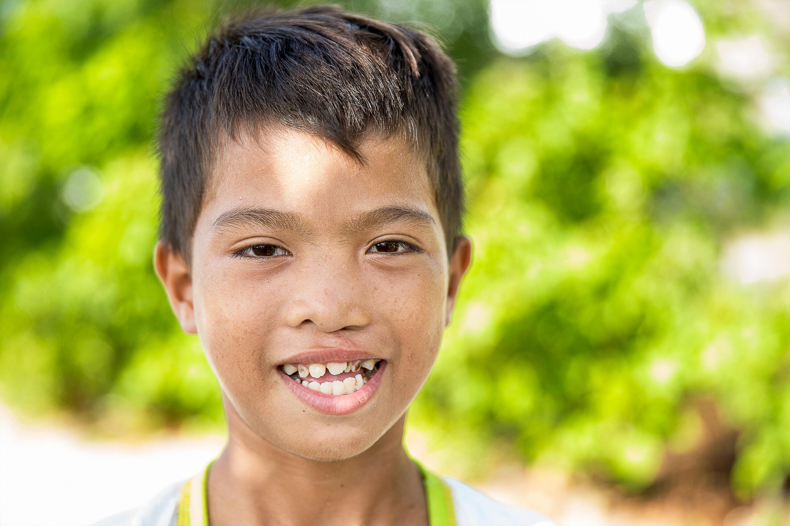 From hurt to healing: Efren's emotional change - Operation Smile Canada