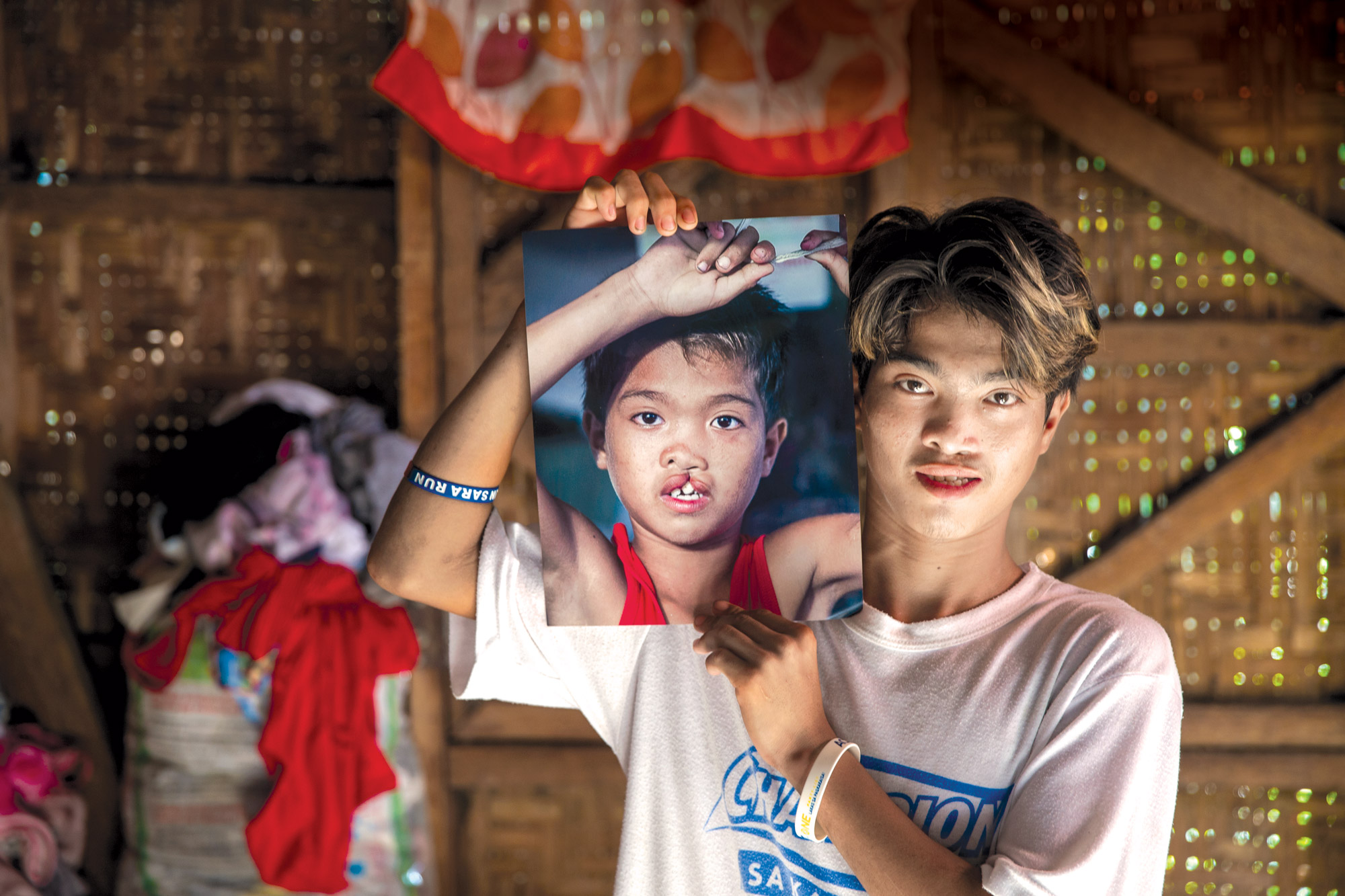 Efren's life transformed! - Operation Smile Canada