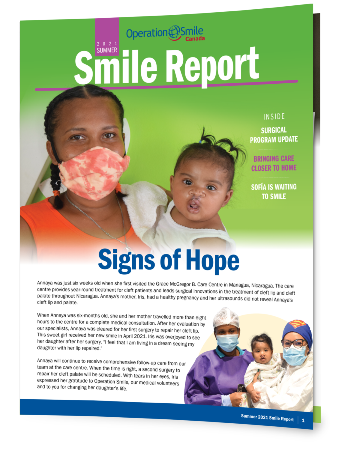 Operation Smile Canada | Every child with a cleft lip or cleft palate ...
