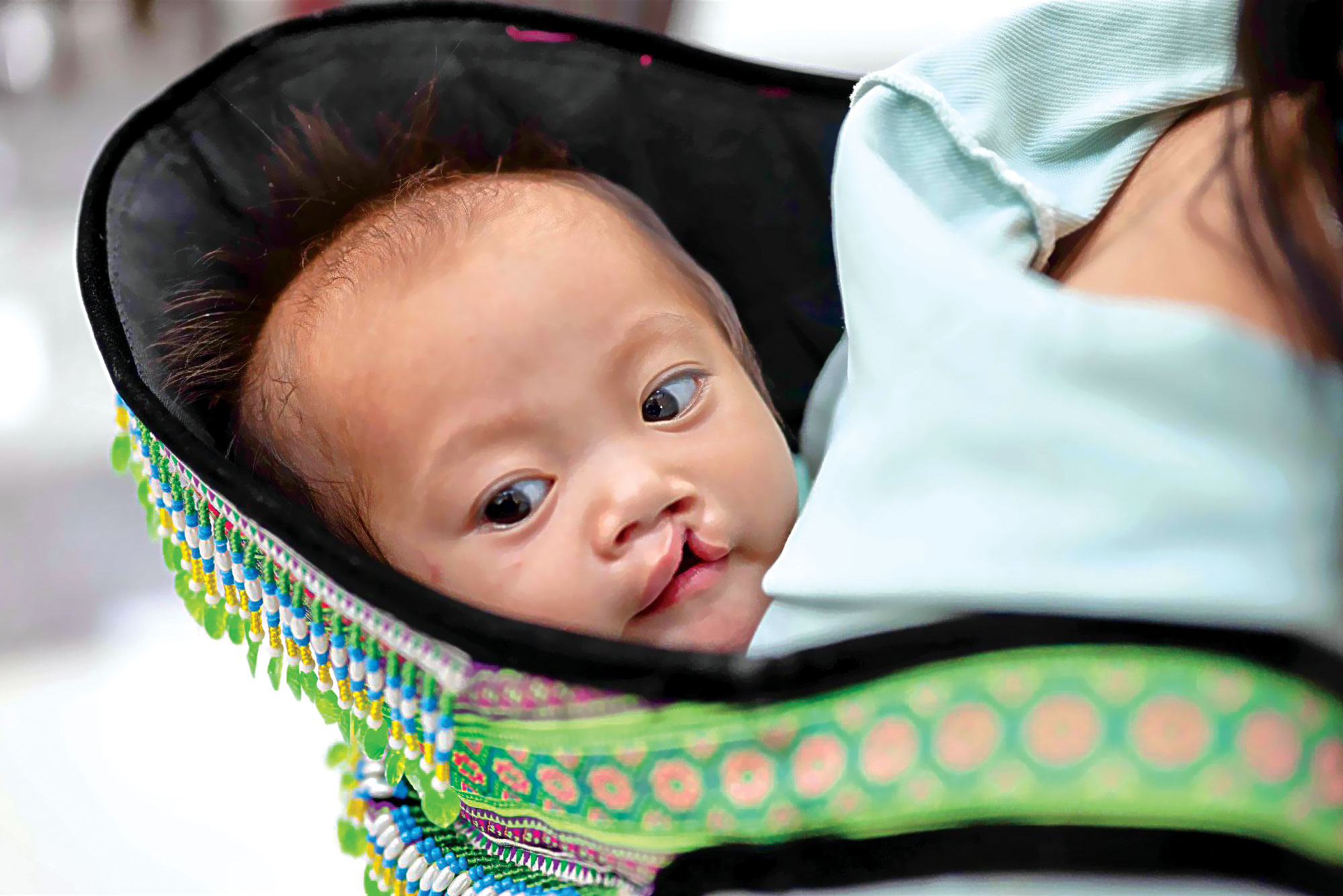 Tong Xuan Nguyen’s Bright Future - Operation Smile Canada
